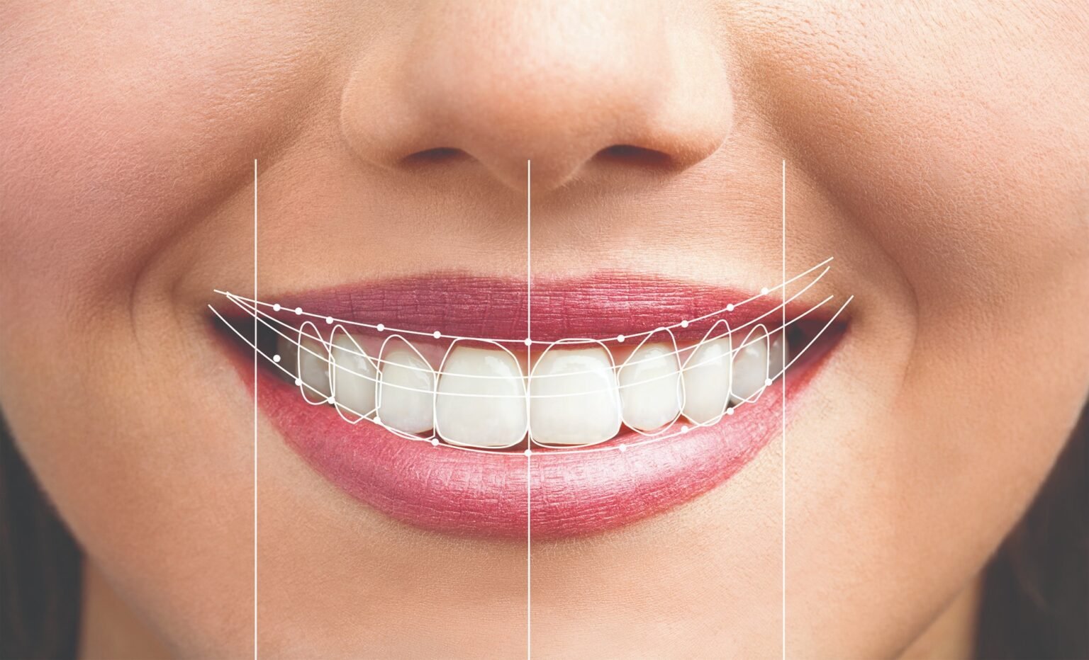 Digital Smile Design: The Authority Guide to Lifestyle Tech-Powered ...